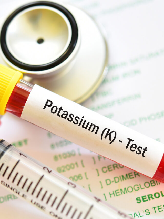 Potassium 101: All You Need To Know About Potassium - Tastylicious