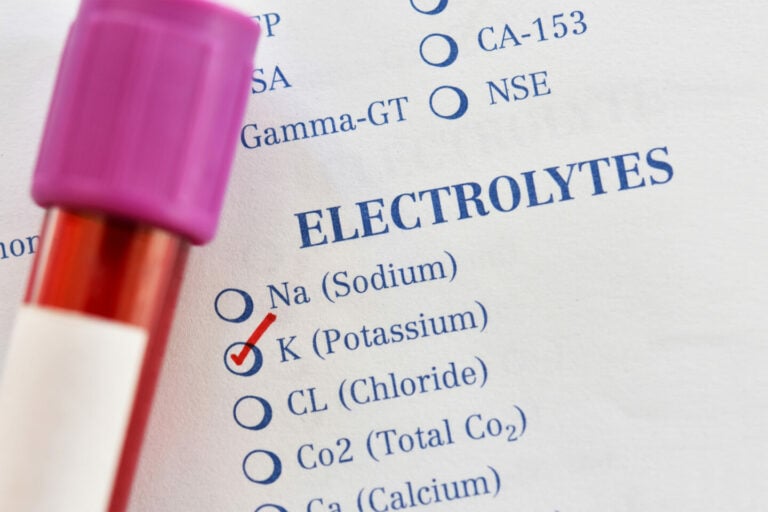 Can You Check Your Potassium Level at Home? - Tastylicious